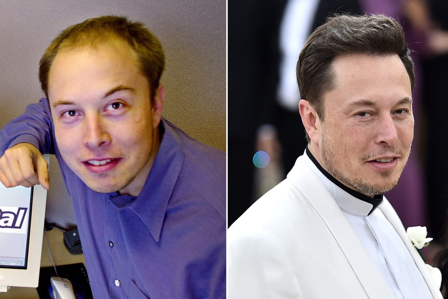 Celebrities Hair Transplant - Ariana Health Center