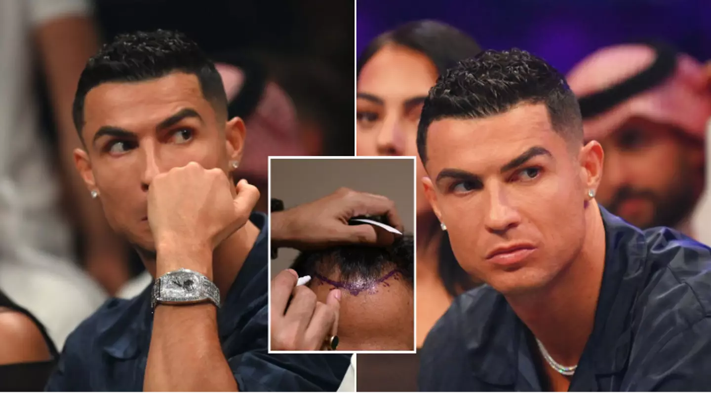 Cristiano Ronaldo Hair Transplant: The Journey to a Perfect Hairline - Ariana Health Center