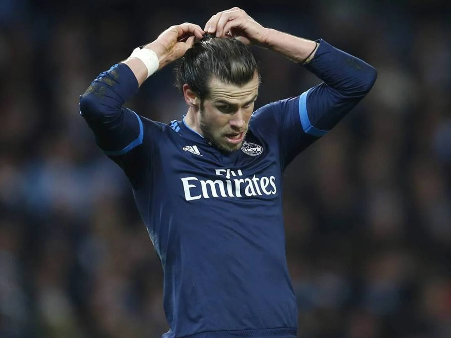 Gareth Bale Hair Transplant - Ariana Health Center